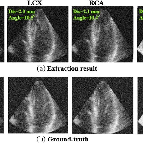 an example of standard plane extraction synthetic dataset noise 10