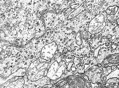 Violations Of The Ultrastructure Of Neurons In The Cerebral Cortex Of Rats With Total Cerebral
