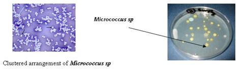 Micrococcus Species Indoor Air Quality Consultants