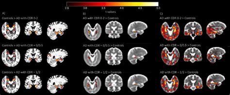 Illustration Of The Results From The Voxel Wise Analysis On Whole Brain Download Scientific