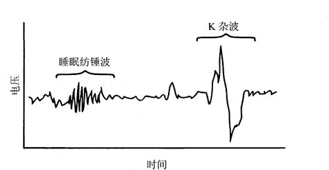 Sleeping Detection Device And Sleeping Detecting And Assisting Method Thereof Eureka Patsnap