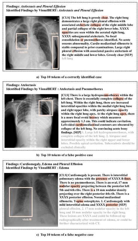 Results Of Three Classification Samples Top 10 Tokens With Highest Download Scientific Diagram