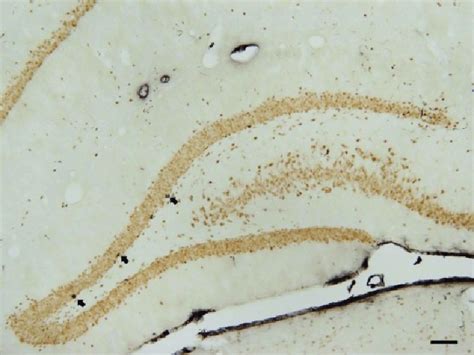 Effects Of Treadmill Exercise On Memory Function A Control Group B Download Scientific