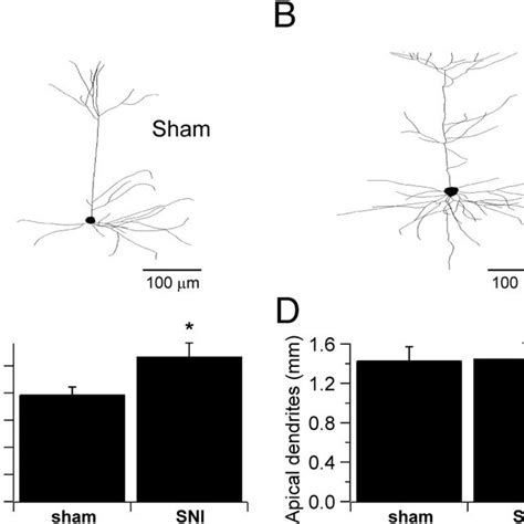 Sni Rat Mpfc Pyramidal Cells Have Longer Basal Dendritic Arbor Camera Download Scientific