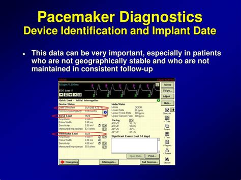 Ppt Pacemaker Diagnostics Powerpoint Presentation Free Download Id3429303