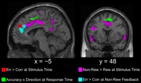 An Overlay Of The Different Areas Of The Cingulate Cortex That Were Download Scientific Diagram