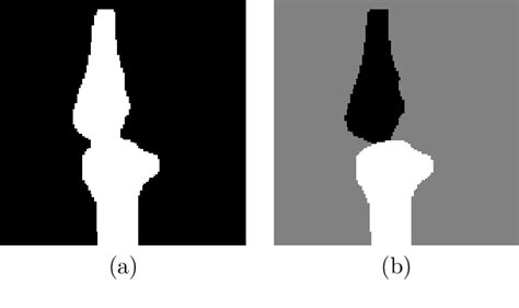 Figure 1 From Automatic Atlas Based Three Label Cartilage Segmentation From Mr Knee Images