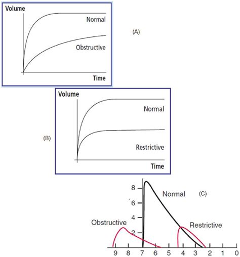 Restrictive Lung Disease Spirometry Fev1 Fvc At Malik Keck Blog