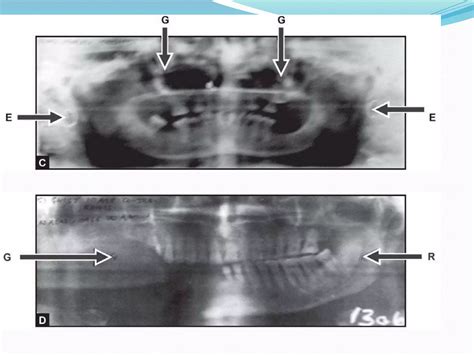 Common Errors In Opg Pptx