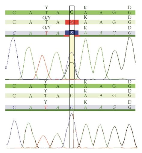 Electropherogram Of Molecular Analysis In The Patient Sample The Upper