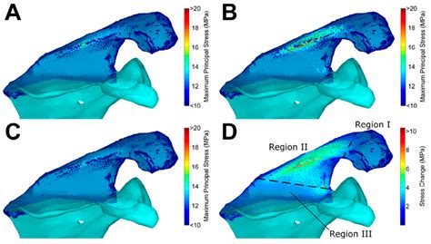 Finite Element Analysis On The Influence Of Implant Positioning In Download Scientific Diagram