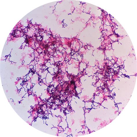 Streptococcus Constellatus · Inaturalist