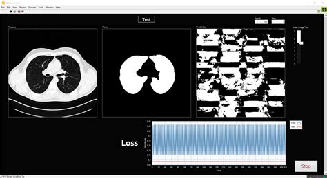 Medical Unet Example Graiphic
