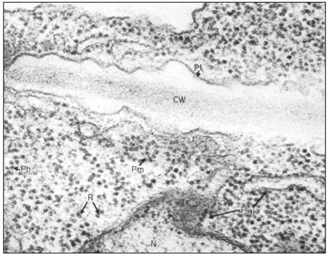 Ribosomes Electron Micrograph Exploring The Cell A Photo Gallery