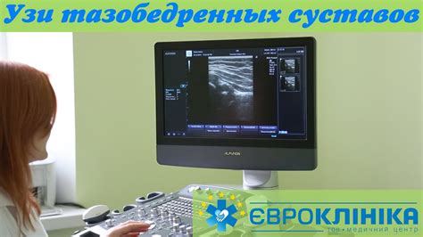 УЗИ ТАЗОБЕДРЕННЫХ СУСТАВОВ! - YouTube