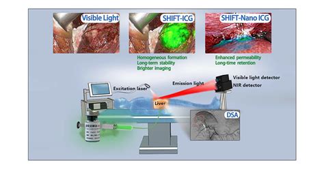 Recent Advances In Interventional Fluorescence Imaging Toward The Precise Visualization Of