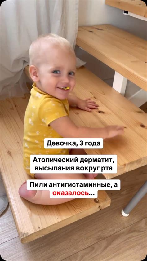 На консультацию ко мне обратилась мама с девочкой ☺️5 лет Жалобы на аденоиды неприятный