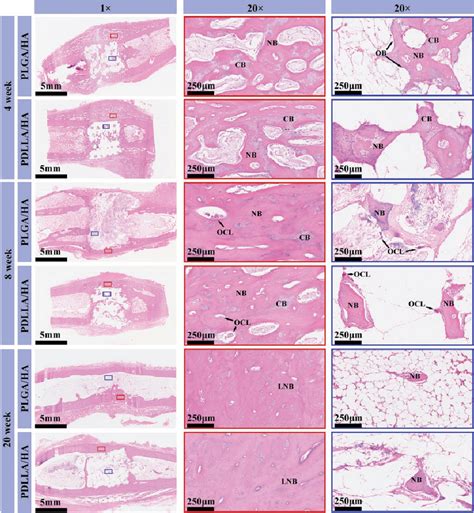 Figure 3 From In Vivo Research On 3d Printed Composite Plga And Pdlla Ha Absorbable Scaffolds
