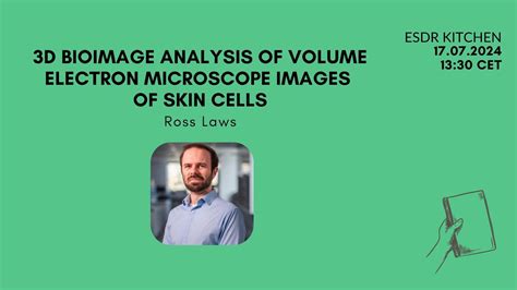 the recipe book ep65 3d bioimage analysis of volume electron