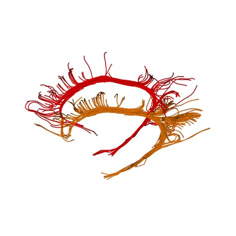 Direct Bundle Registration — Dipy 1110 Documentation