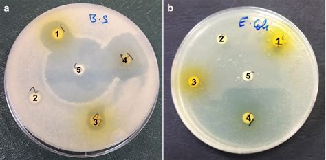 In Vitro Evaluation Of The Antimicrobial Activity Of Aqueous And Ethanolic Extracts Of Four