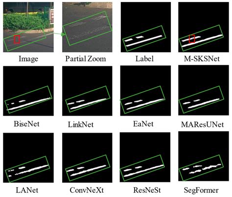M Sksnet Multi Scale Spatial Kernel Selection For Image Segmentation