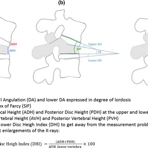 Radiological Analysis A Linear Measurements B Angular Measurements C