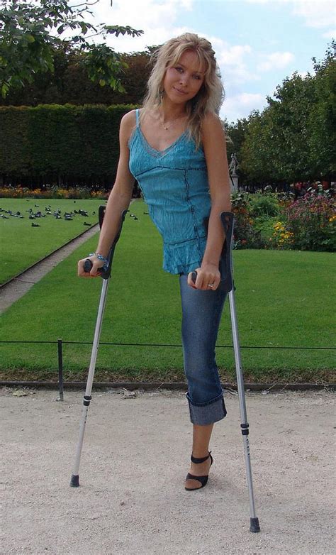 Laura Hip Disarticulation By Carlvilla On Deviantart