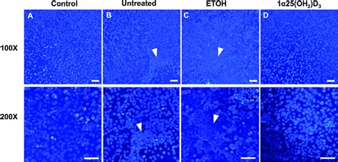 confirmation of mngc reduction in 1α 25 oh 2 d 3 pretreated a549