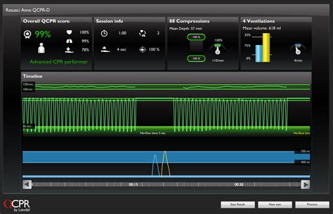 Resusci Anne Qcpr Upgrade Laerdal Medical
