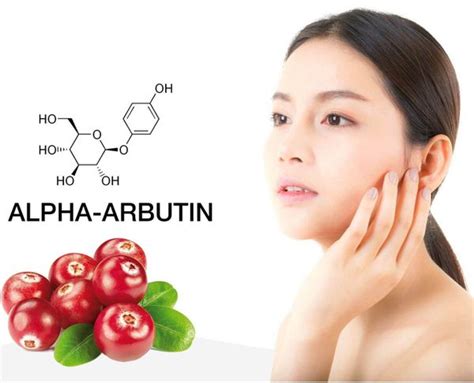 Melasma Treatment Choosing Between Arbutin And Hydroquinone Good