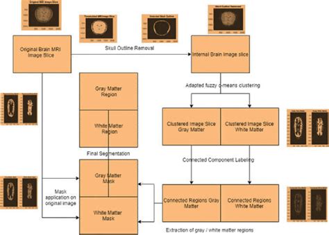 block diagram of automatic gray and white matter segmentation