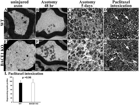 Similar Degree Of Axonal And Myelin Degeneration In Wt And Bace1 Ko