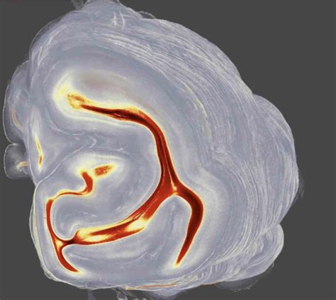 HPC Connects How Supercomputers Are Unraveling The Mystery Of The Human Brain Inside HPC AI