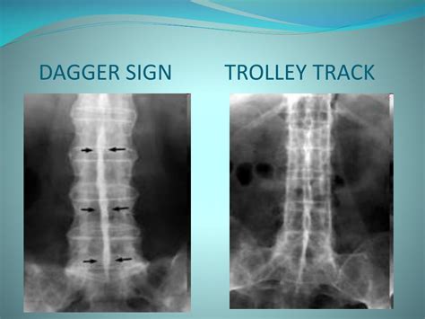 Ppt Signs In Radiology Powerpoint Presentation Free Download Id510632