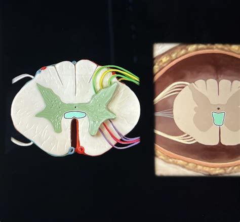 Spinal Cord Flashcards Quizlet