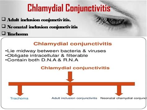 Chlamydia Conjunctivitis Ppt