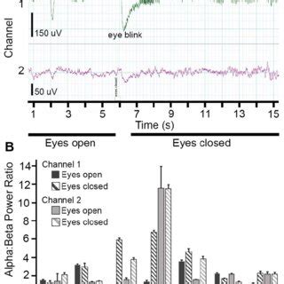 A 1 Channel EEG Recording During Eyes Open And Eyesclosed A Download Scientific Diagram
