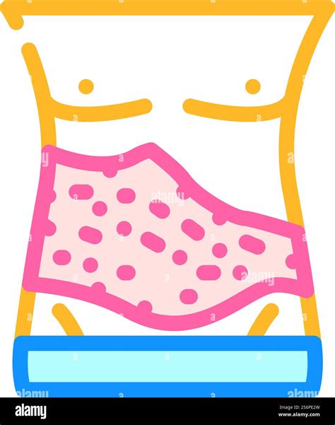 Shingles Skin Disease Color Icon Vector Shingles Skin Disease Sign