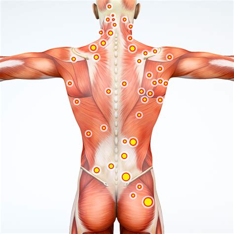 Myofascial Pain Syndrome Can Remedial Massage Help Fremantle