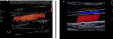 BASIC DOPPLER FUNCTIONS Flashcards Quizlet