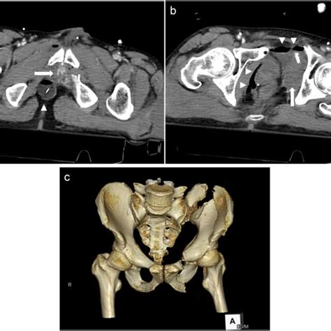 Contrast Enhanced Computed Tomography Of The Patient On Arrival At Our Download Scientific