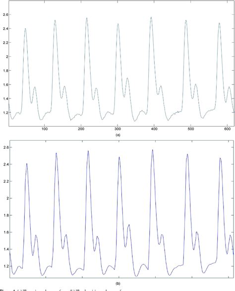 Figure 1 From A More Effective Method Of Extracting The Characteristic Value Of Pulse Wave