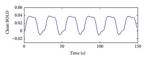 fmri synthetic data synthesis against a periodic stimulus s f v