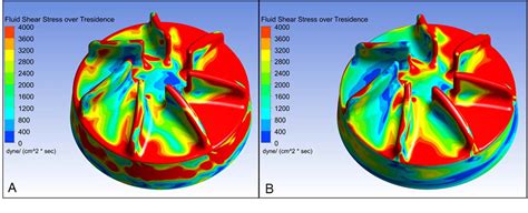 Figure 3 From Thrombotic Depositions On Right Impeller Of Double‐ended Centrifugal Total