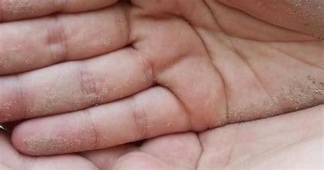 Tiny Toad Album On Imgur