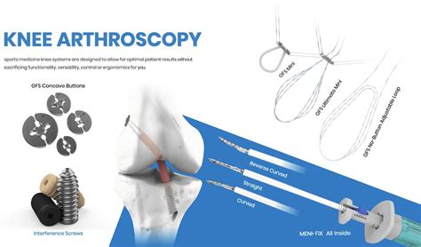 Knee Arthroscopy Products Yasmin Medical