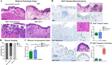 Bcg Elicits A Superior Anti Tumor Immune Response Compared With