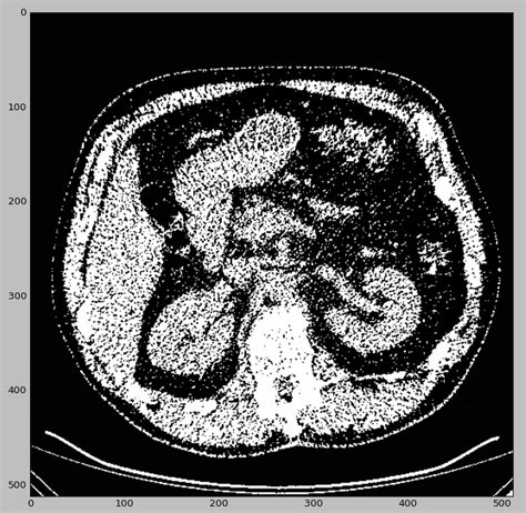 Medical Imaging Python Read And Convert Raw 3d Image File Stack
