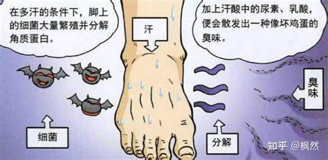 为什么天天洗脚，还是脚臭？大数据请把这篇推给脚臭星人 知乎